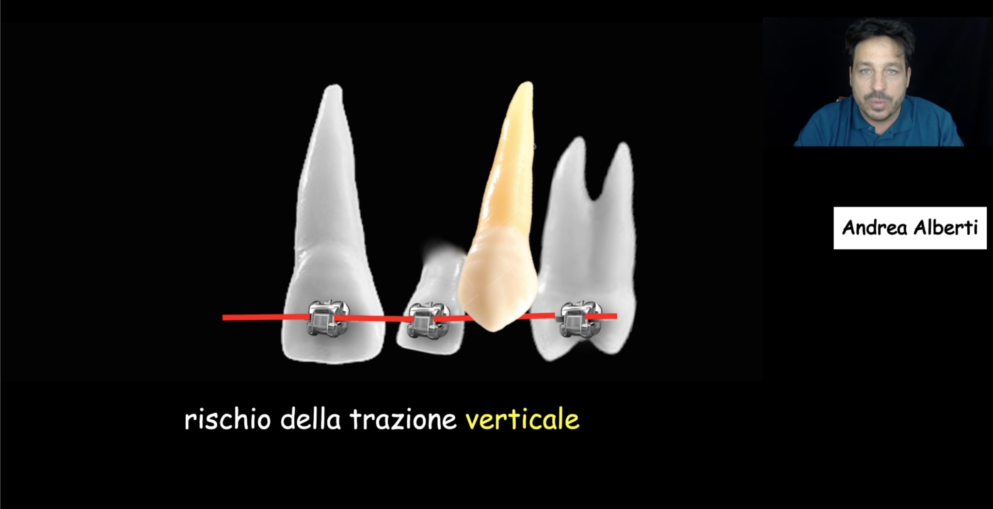 GESTIONE RAGIONATA DEL CANINO INCLUSO VESTIBOLARE - Orthomand
