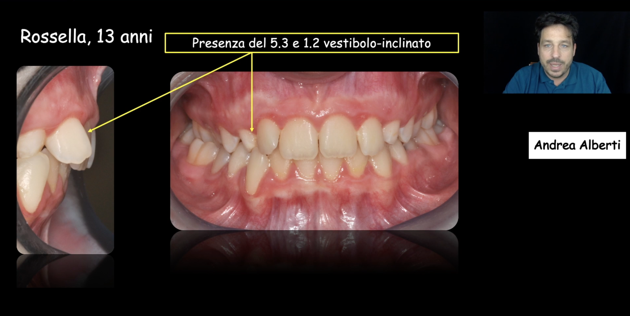 GESTIONE RAGIONATA DEL CANINO INCLUSO VESTIBOLARE - Orthomand