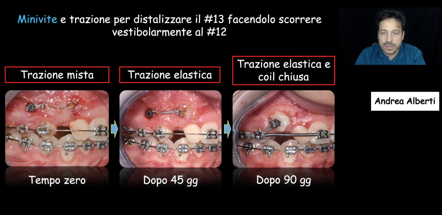 GESTIONE RAGIONATA DEL CANINO INCLUSO VESTIBOLARE - Orthomand