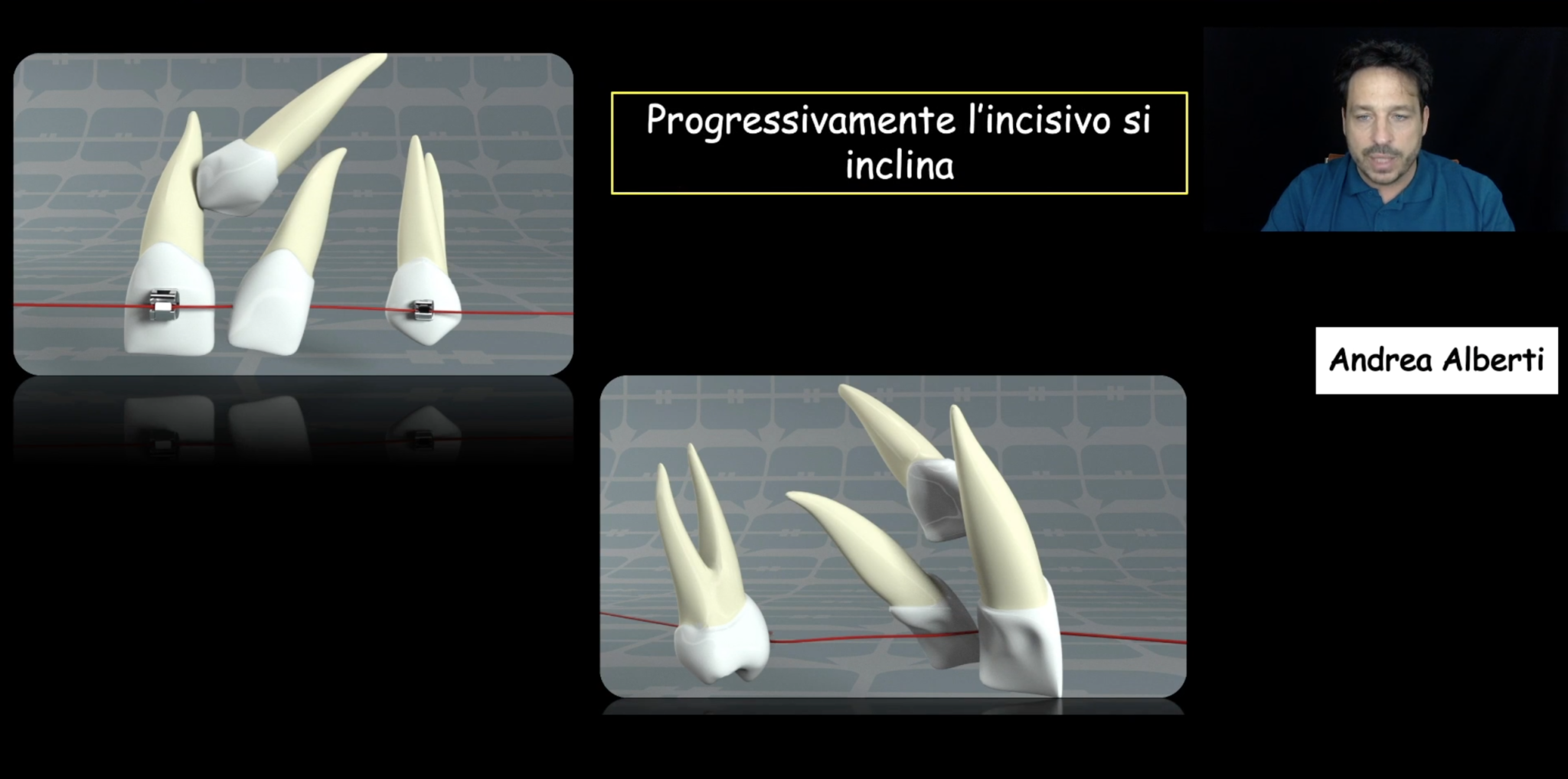 GESTIONE RAGIONATA DEL CANINO INCLUSO VESTIBOLARE - Orthomand