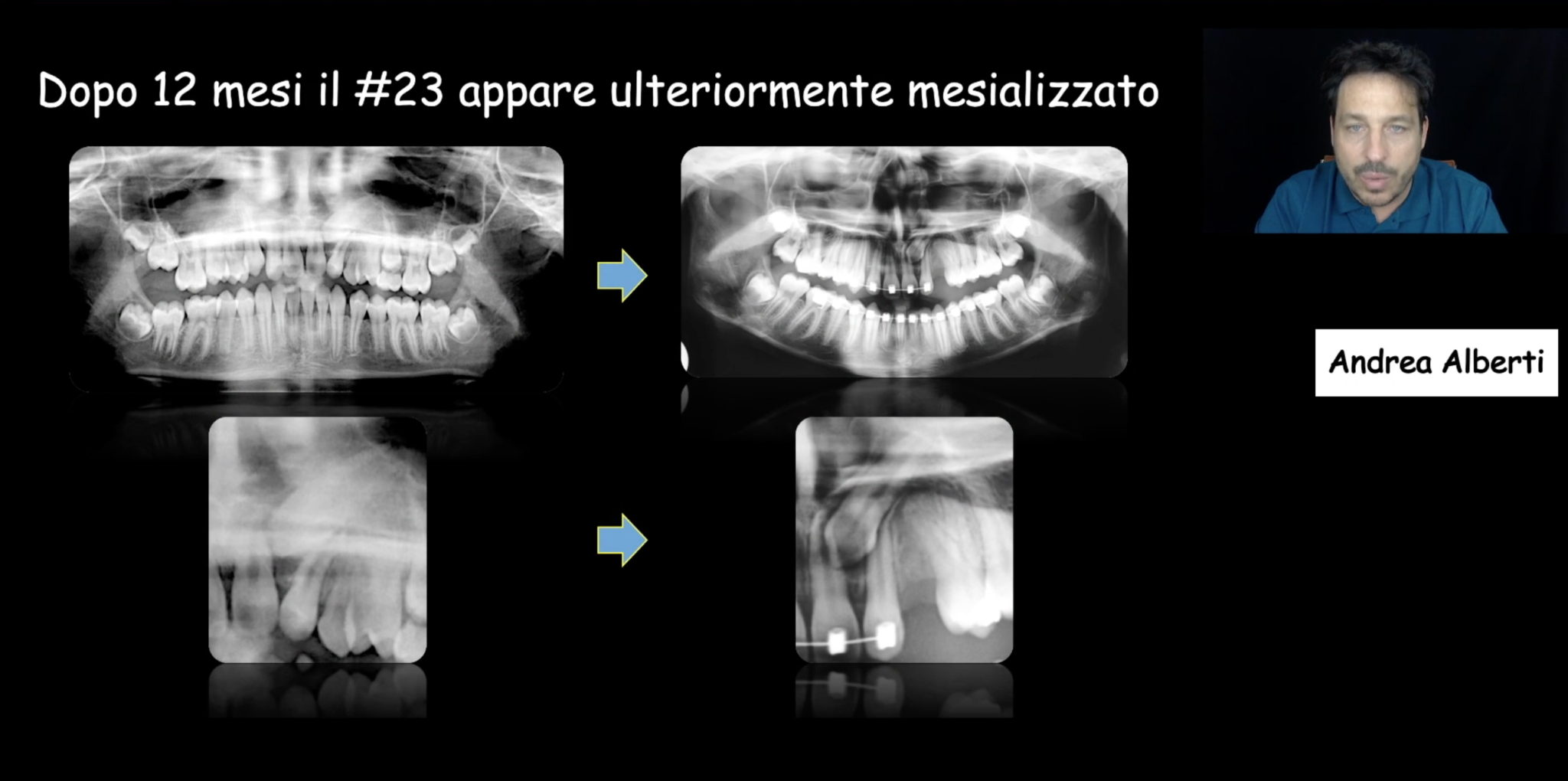 GESTIONE RAGIONATA DEL CANINO INCLUSO VESTIBOLARE - Orthomand