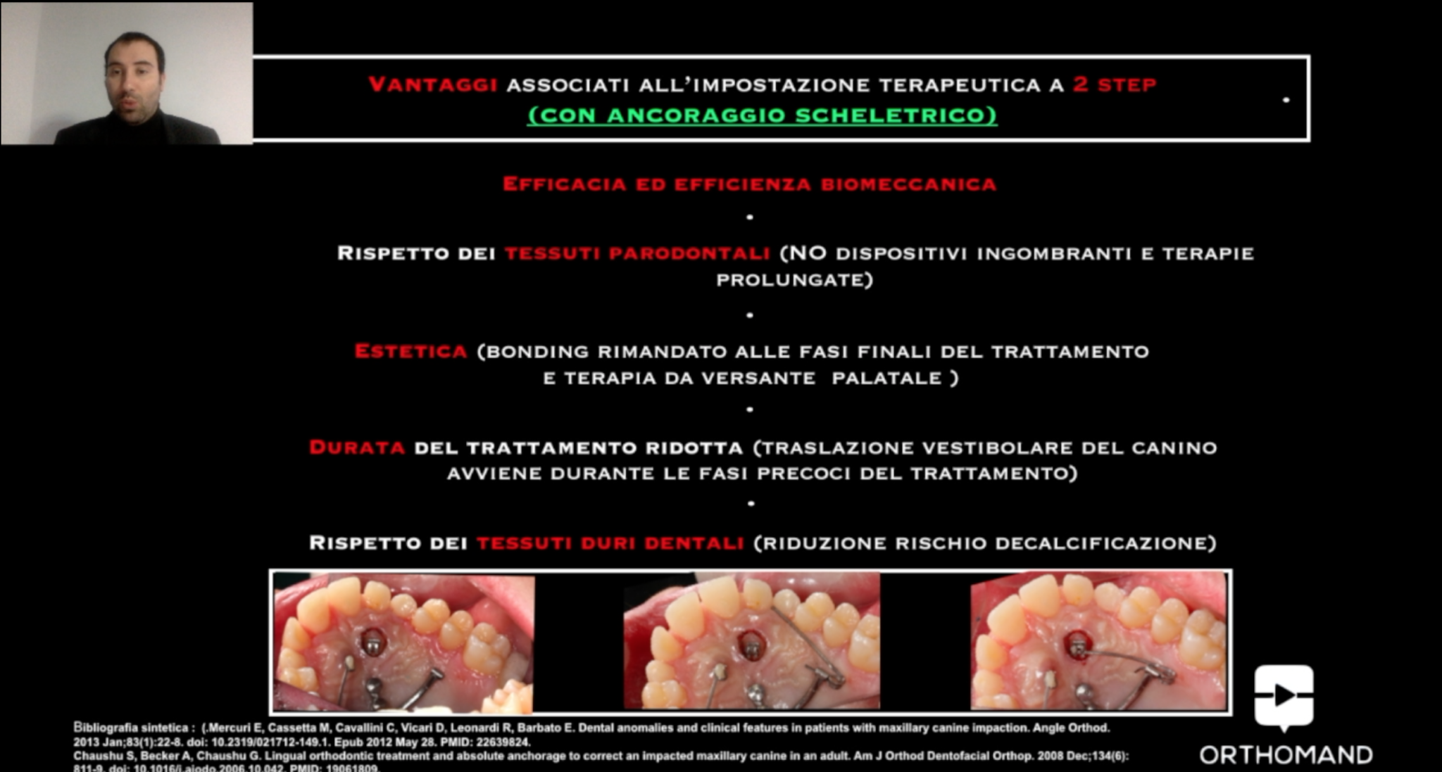 LA DISINCLUSIONE DEL CANINO PALATALE NELL’ERA DIGITALE - Orthomand