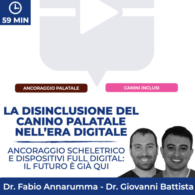LA DISINCLUSIONE DEL CANINO PALATALE NELL’ERA DIGITALE - Orthomand