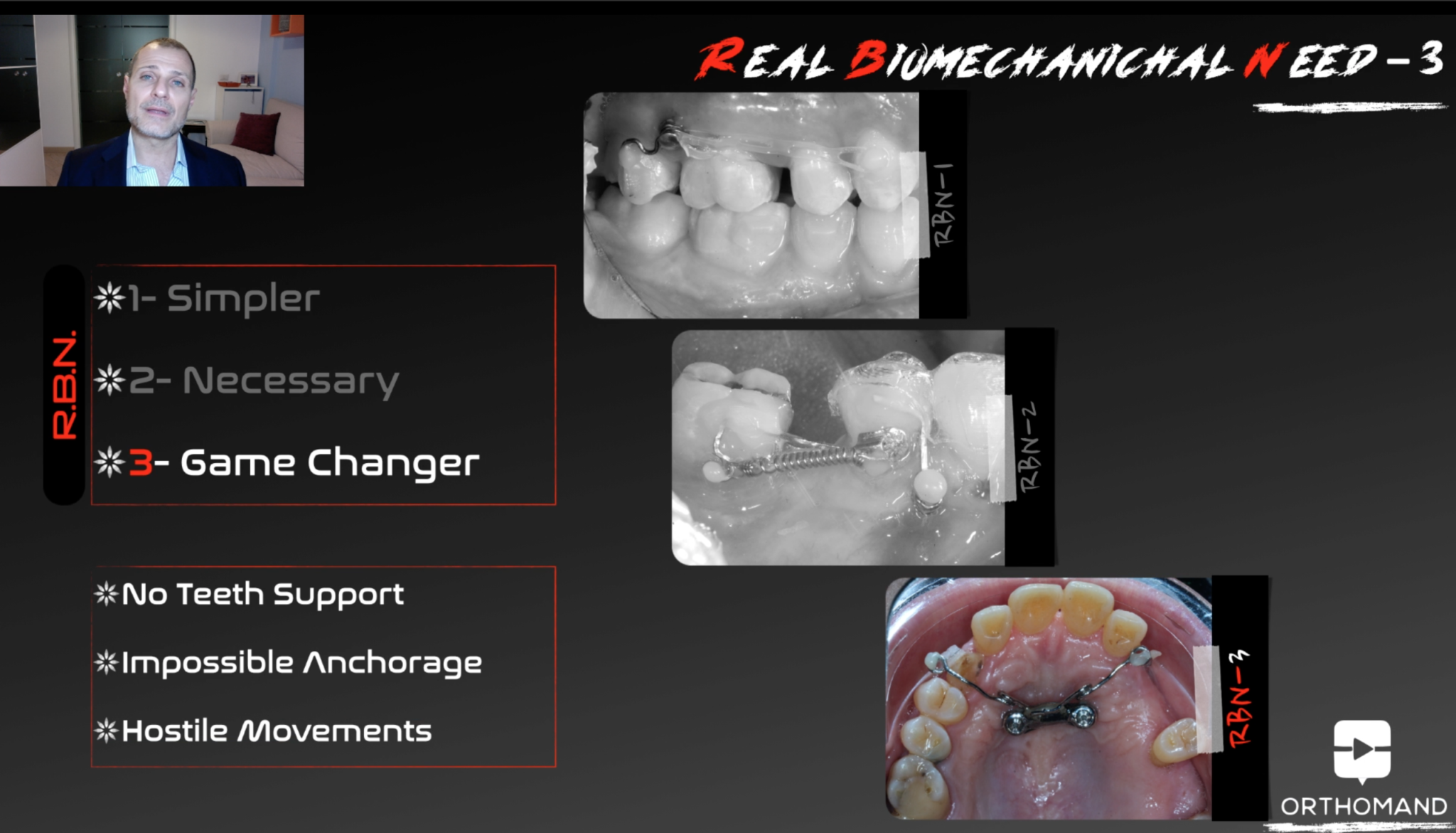 MINIVITI E INVISALIGN Vol 3: le tads "game changer" - Orthomand